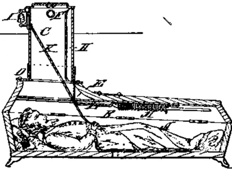 Catalepsia: Manifestaciones Clínicas, Causas, Diagnóstico e Impacto ...